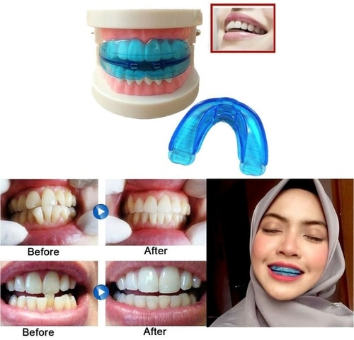 PERAPIH GIGI TANPA BEHEL - PERAPIH GIGI